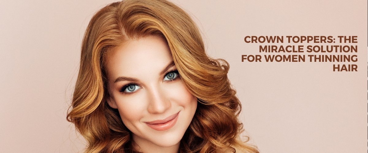 Crown Toppers: The miracle Solution for women Thinning Hair – segohair.com